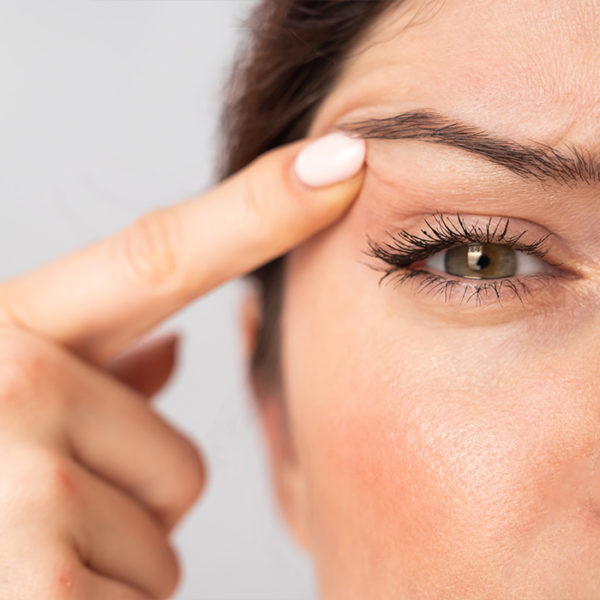 Upper Eye Filler - Skin Lab Beauty Clinic